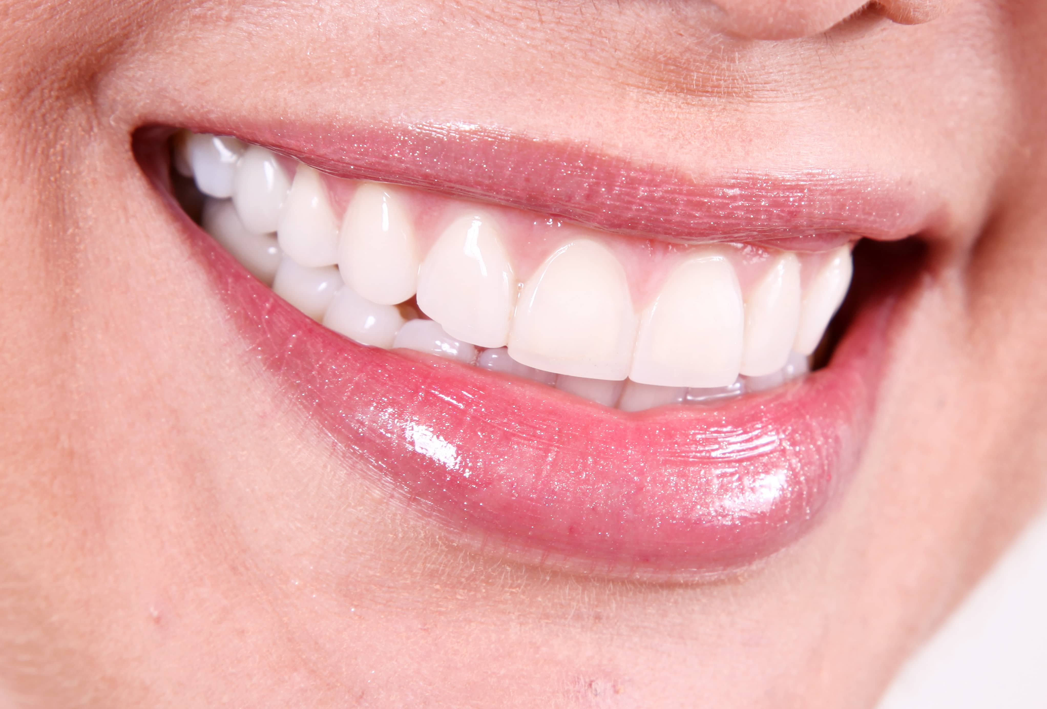 Cosmetic Work Can Address Problems With An Unsightly Tooth | St. Louis, MO